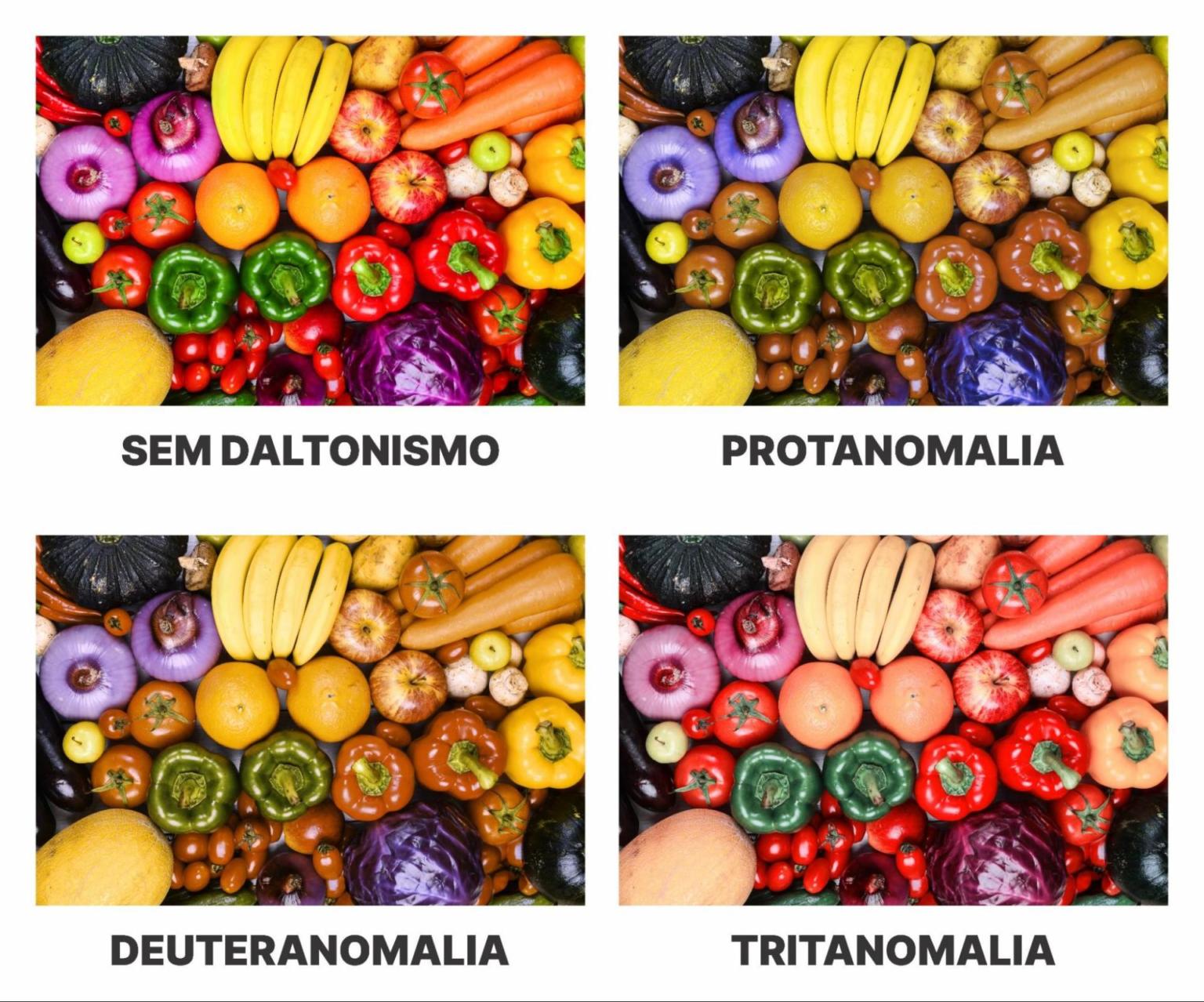 Daltonismo: Causas, Sintomas, Tipos E Características – AHJNN